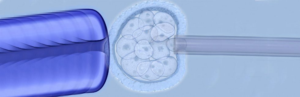 Is Genetic Testing for IVF Worth It?
