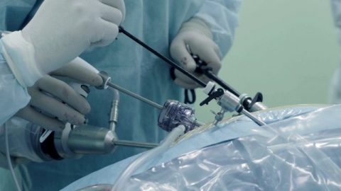 Uterus Removal (Hysterectomy) Surgery in Mumbai, India - Dr. Jay Mehta