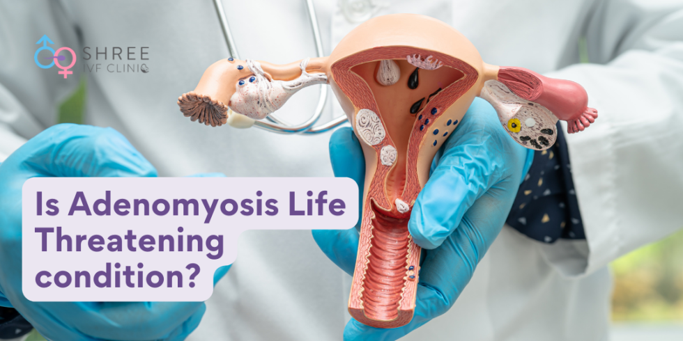 Adenomyosis Is It A Dangerous Condition